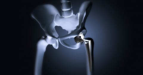 Best Orthopedic Surgeon In Bangalore | Dr. Narayan Hulse